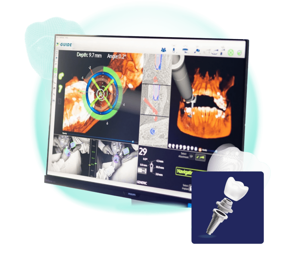 Oral Surgeon Harrisonburg VA | Staunton VA | Legacy Surgery