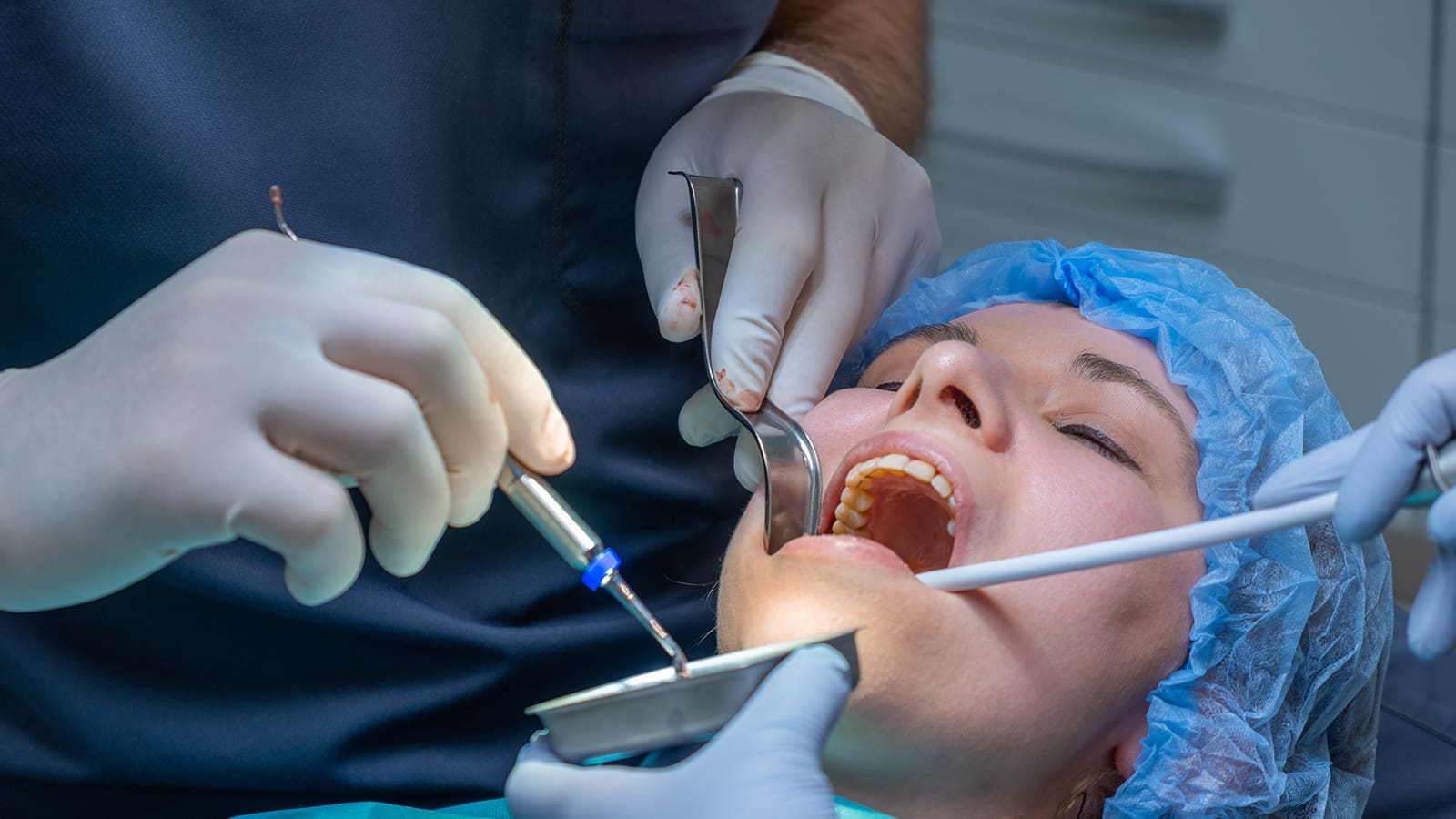 Learn how socket preservation helps maintain jawbone strength, prevent ...